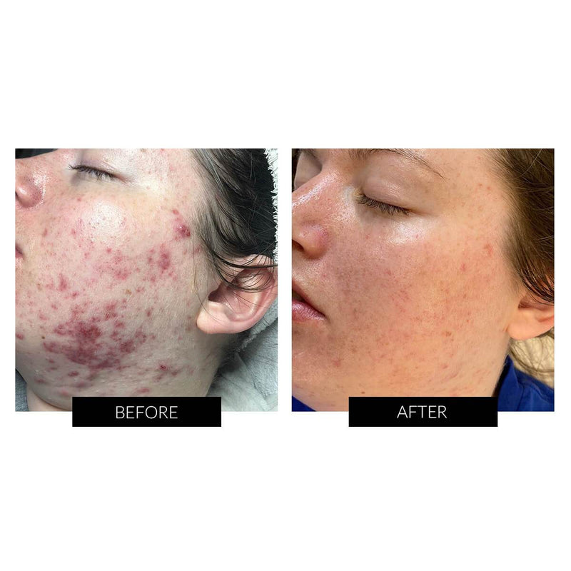 Dermalux Flex MD Dispositivo per la terapia a luce LED | CurrentBody IT