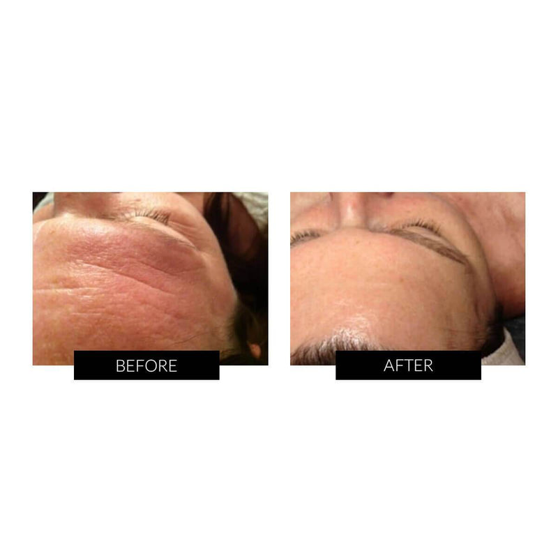 Dermalux Flex MD Dispositivo per la terapia a luce LED | CurrentBody IT